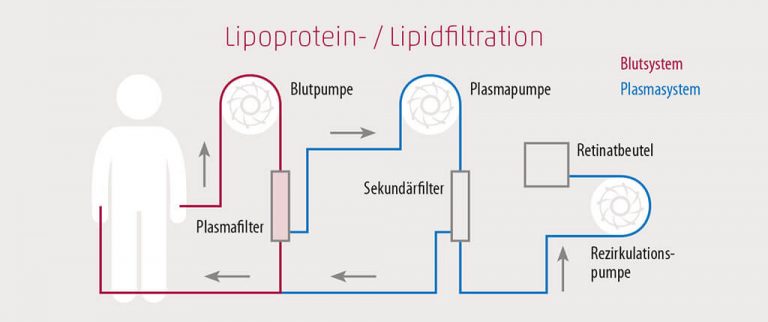 Apheresezentrum Mittelhessen – Lipidzentrum Mitelhessen